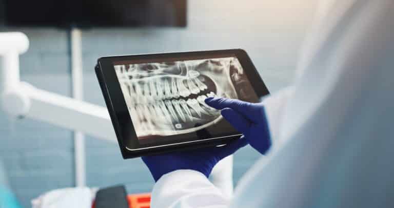 The Role Of Routine Dental X-Rays In Early Detection